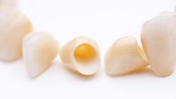 How a Dental Crown Keeps Your Tooth Viable | Crowns and Bridges ...