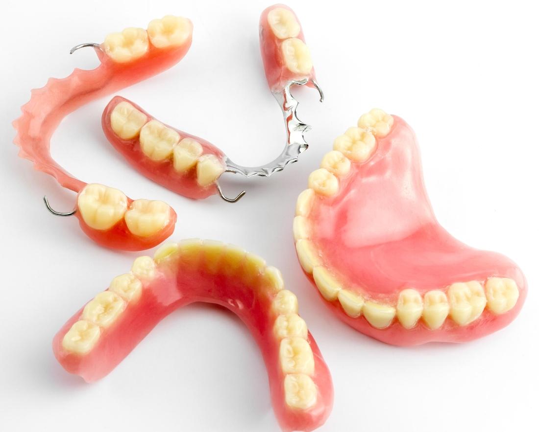 Learn About Modern Dentures Springfield IL | Ruggless Dental Blog
